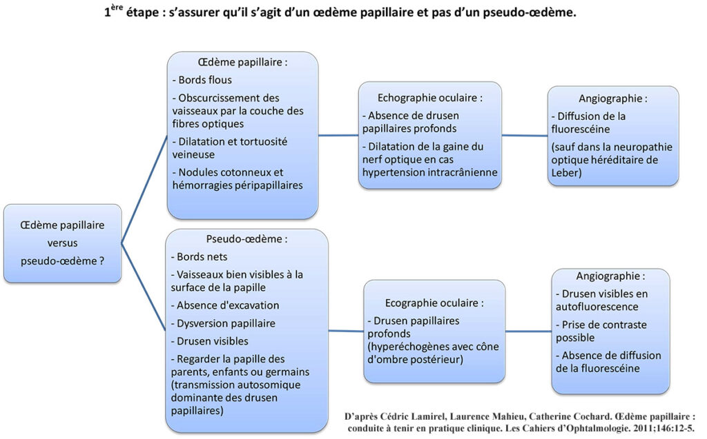 Conduite à tenir devant un œdème papillaire de stase – Club de Neuro ...