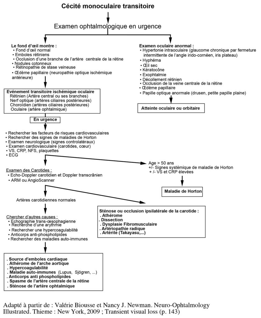 Cécité monoculaire transitoire – Club de Neuro-Ophtalmologie Francophone